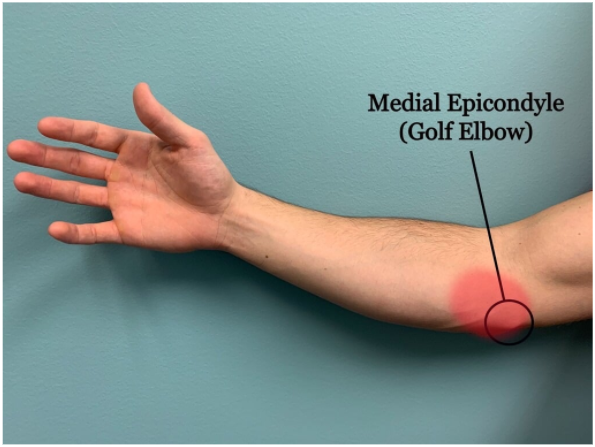 Tennis Elbow Treatment, Symptoms and Causes