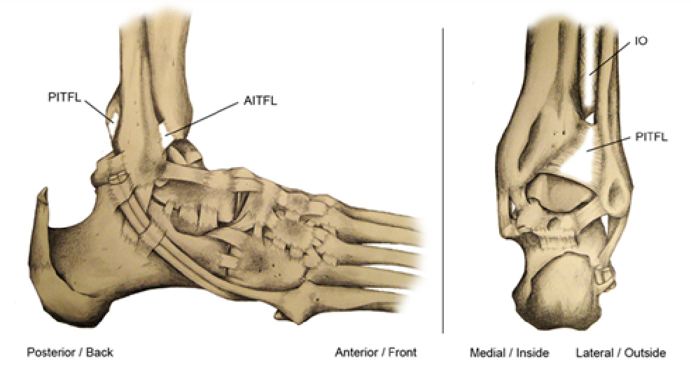 HOW DO I KNOW IF I HAVE A HIGH ANKLE INJURY?